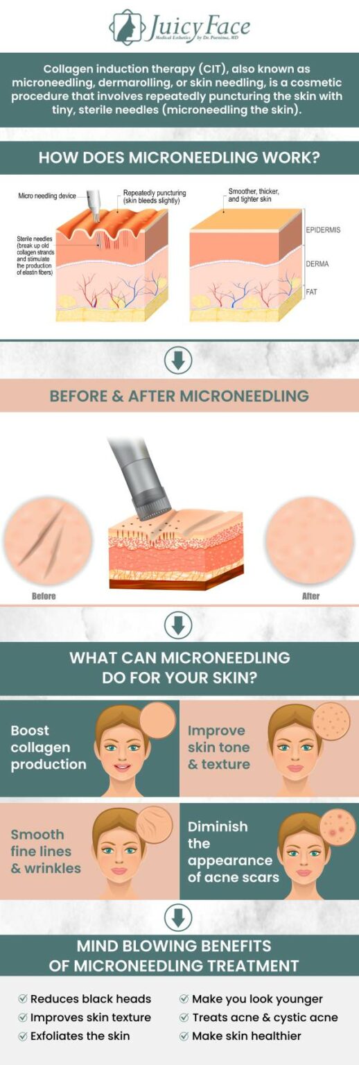 RF Microneedling Treatment Specialist Near Me in Denver, CO